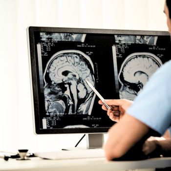 Whole Body MRI Price Turkey | İstanbul Med Assist